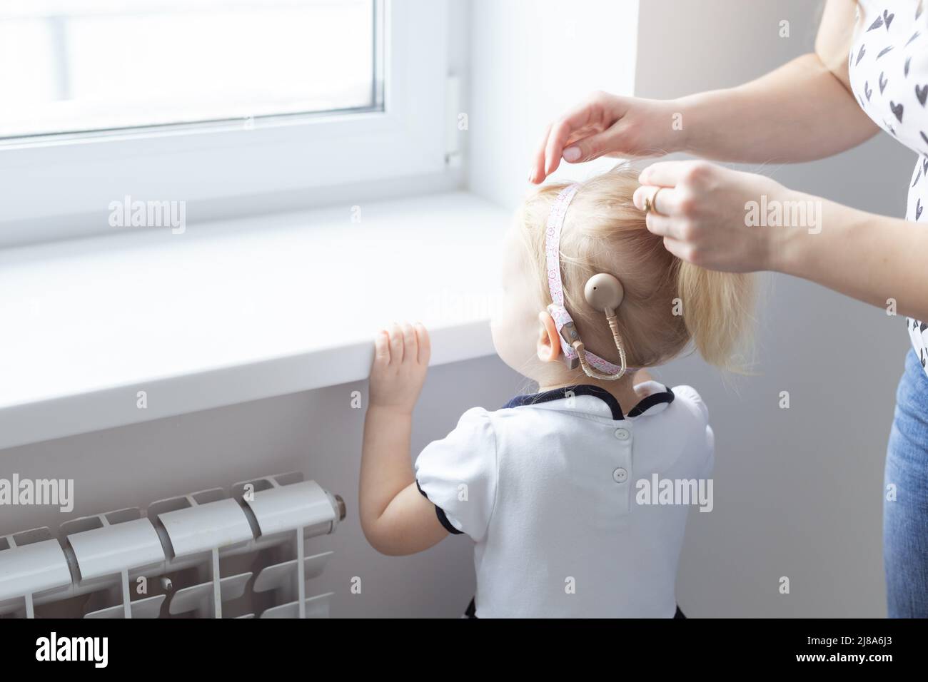 Cochlear implant on baby girl's head. Hearing aid and deafness concept ...