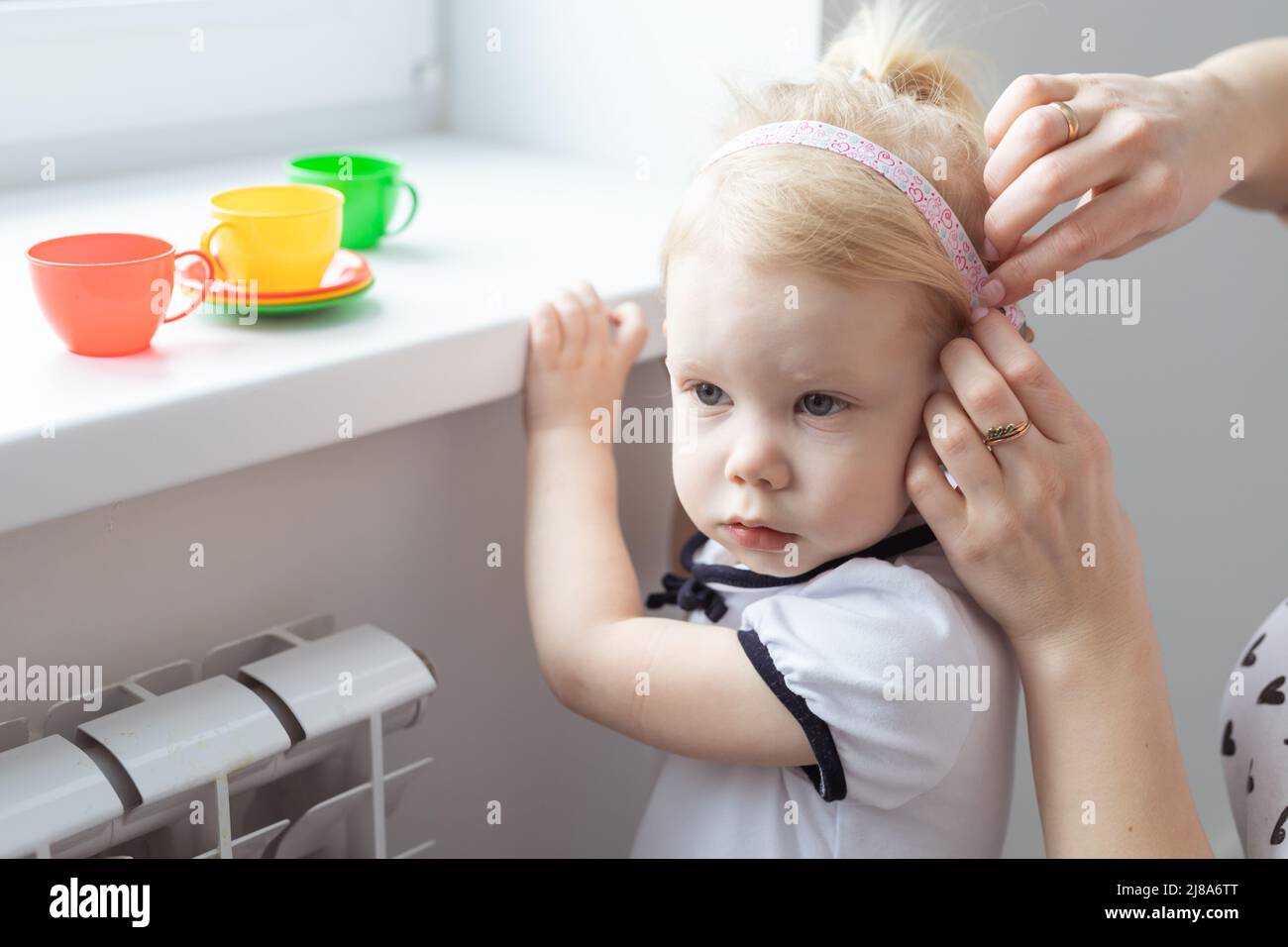 Cochlear implant on baby girl's head. Hearing aid and deafness concept ...