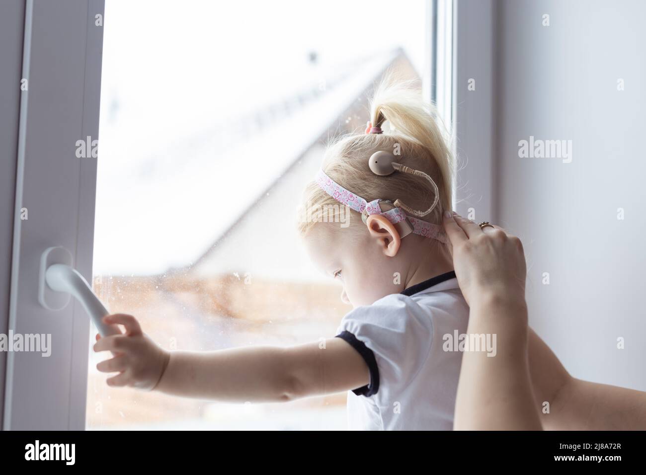 Cochlear implant on baby girl's head. Hearing aid and deafness concept ...