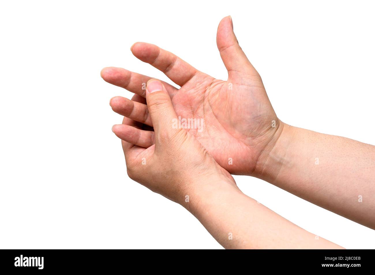 Arthritis Hands Pain