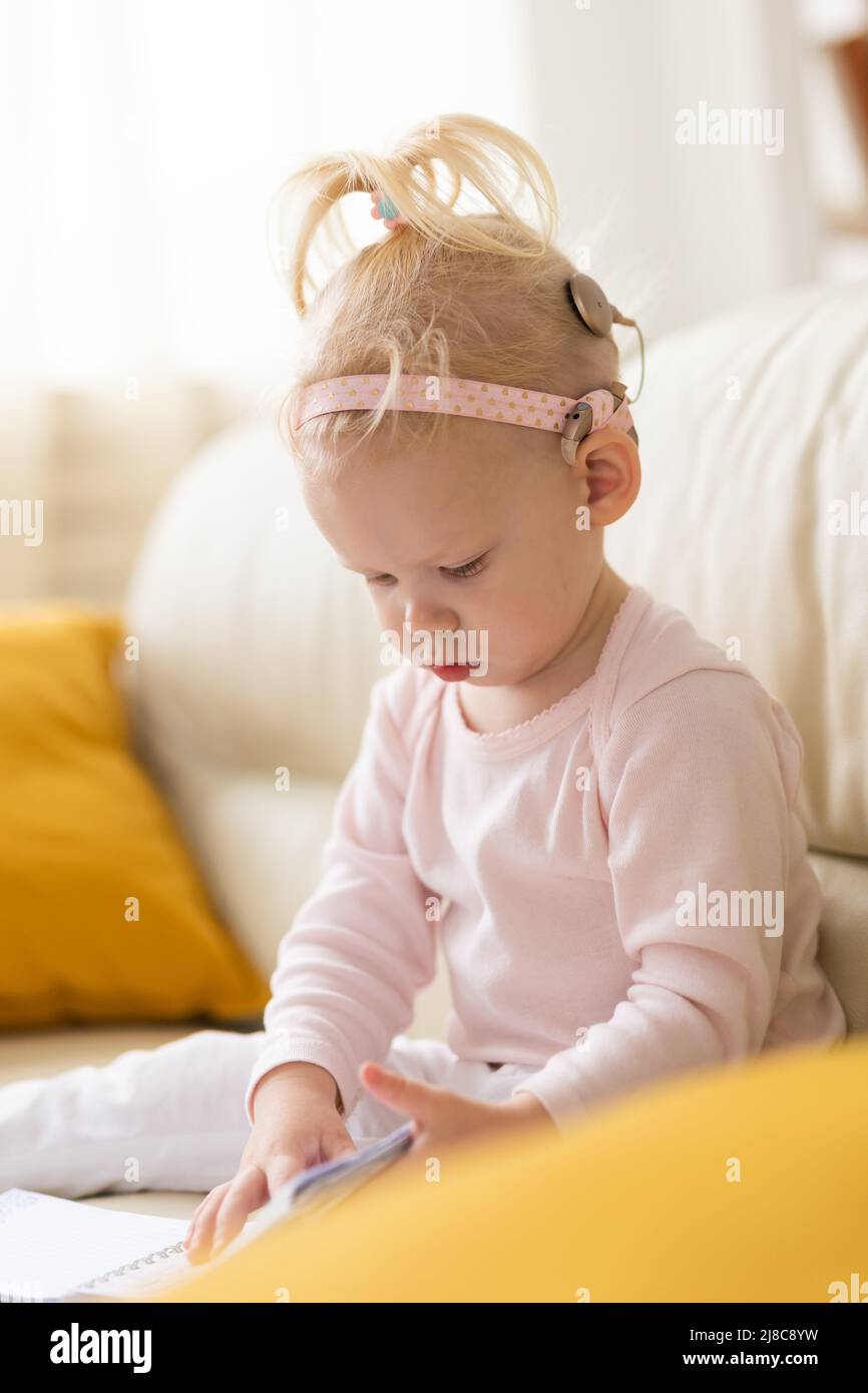 Baby with cochlear implants at home. Deafness and medical technology ...