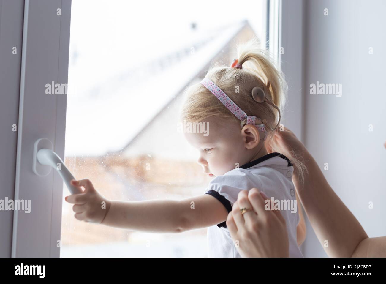 Cochlear implant on baby girl's head. Hearing aid and deafness concept ...