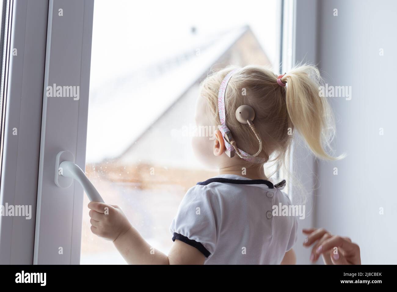 Cochlear implant on baby girl's head. Hearing aid and deafness concept ...