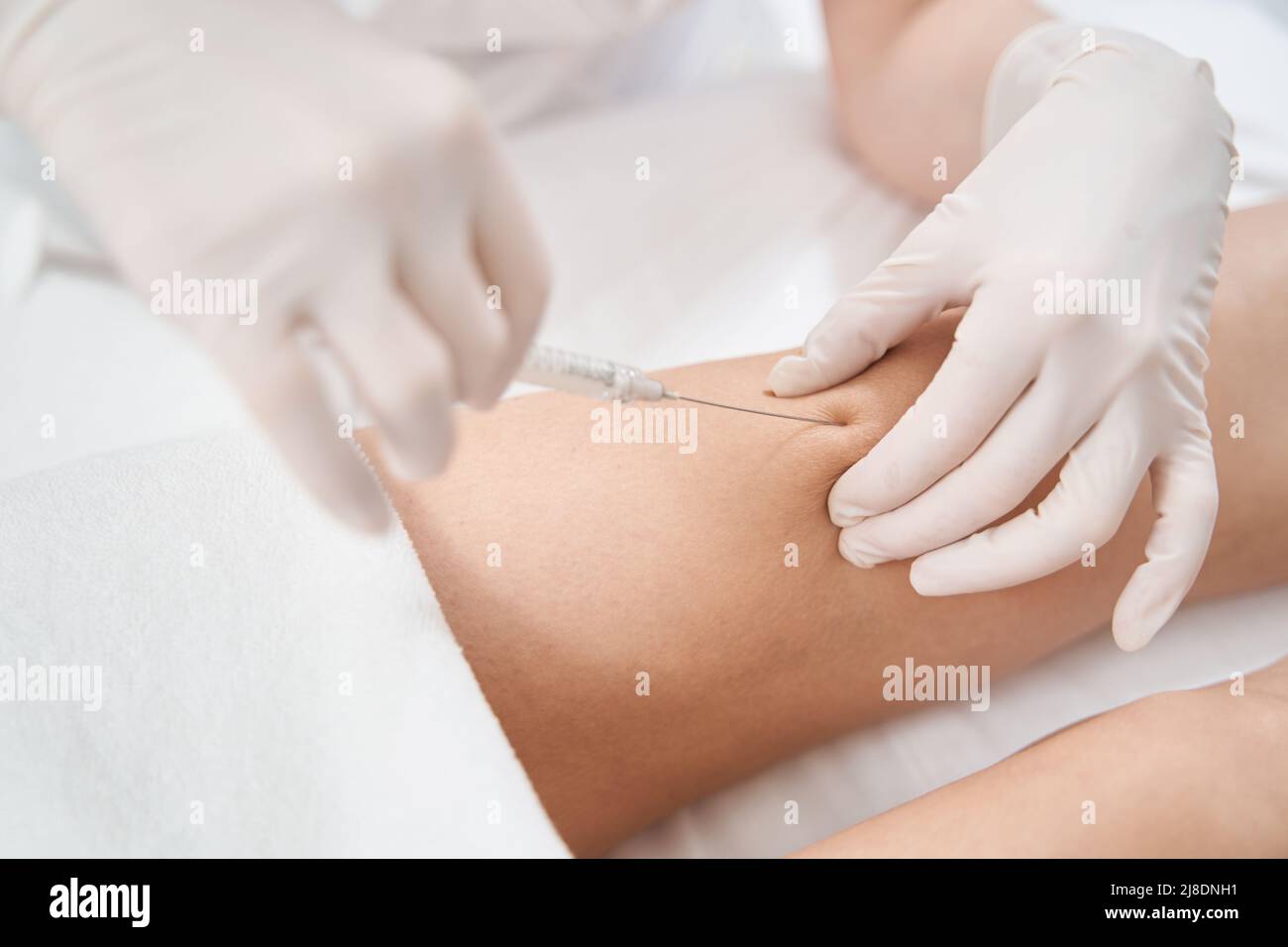 Hyaluronic knee hi-res stock photography and images - Alamy