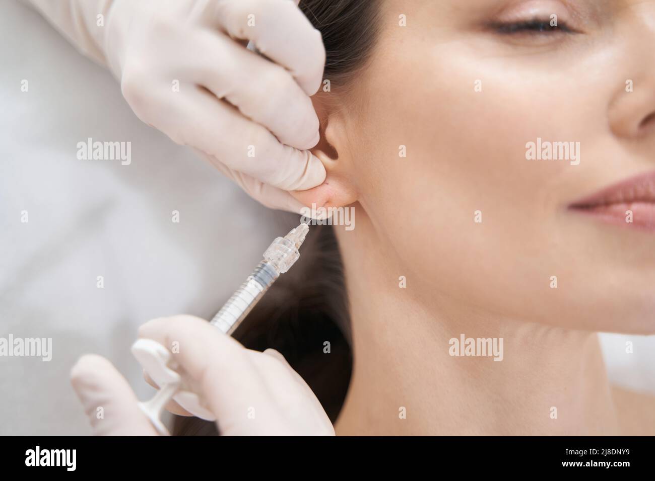 Hyaluronic ear hi-res stock photography and images - Alamy