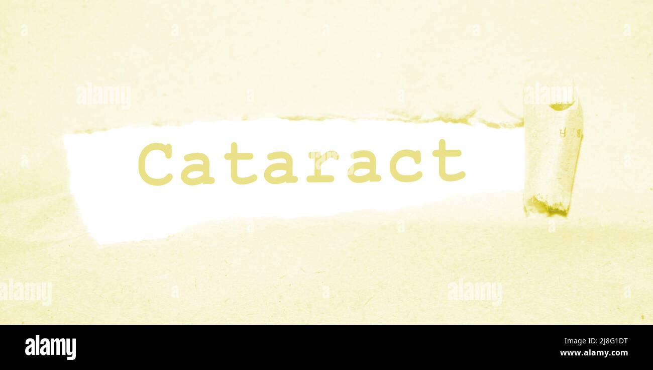 Cataract word written under brown torn paper. Eyes healthcare concept ...