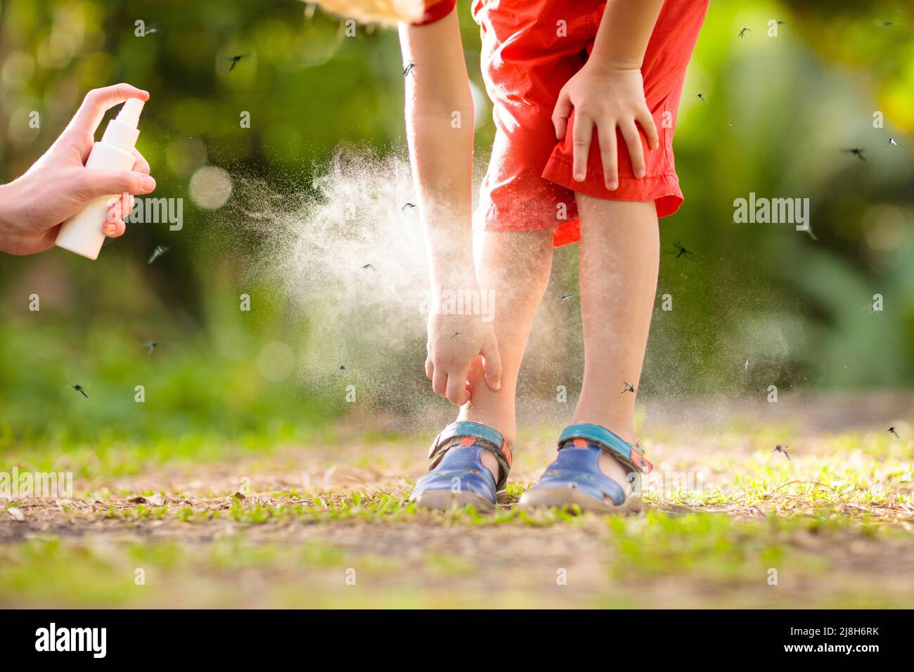 Child insect bite hi-res stock photography and images - Alamy
