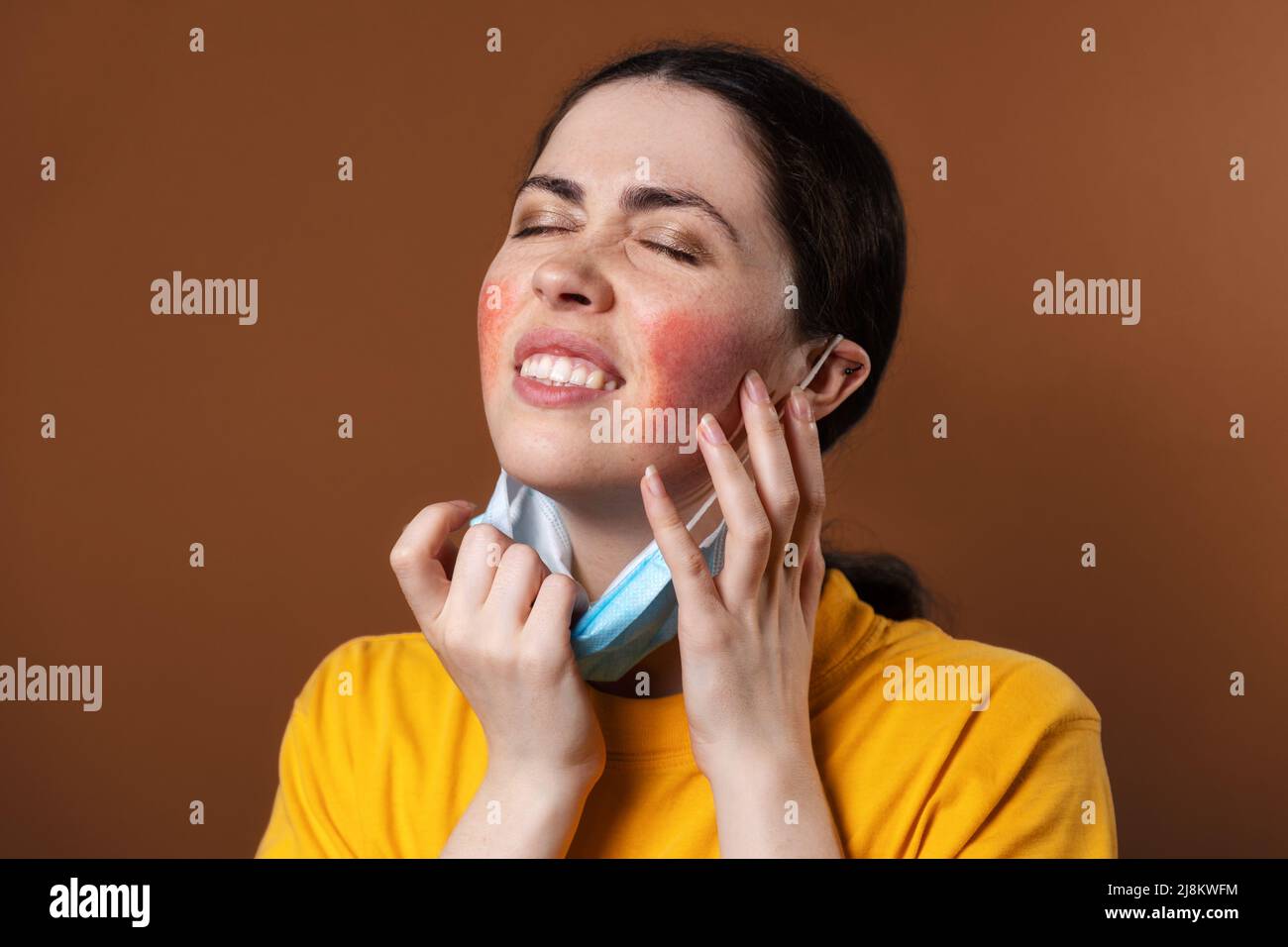 Rosacea. A young upset woman nervously scratches her face with her ...