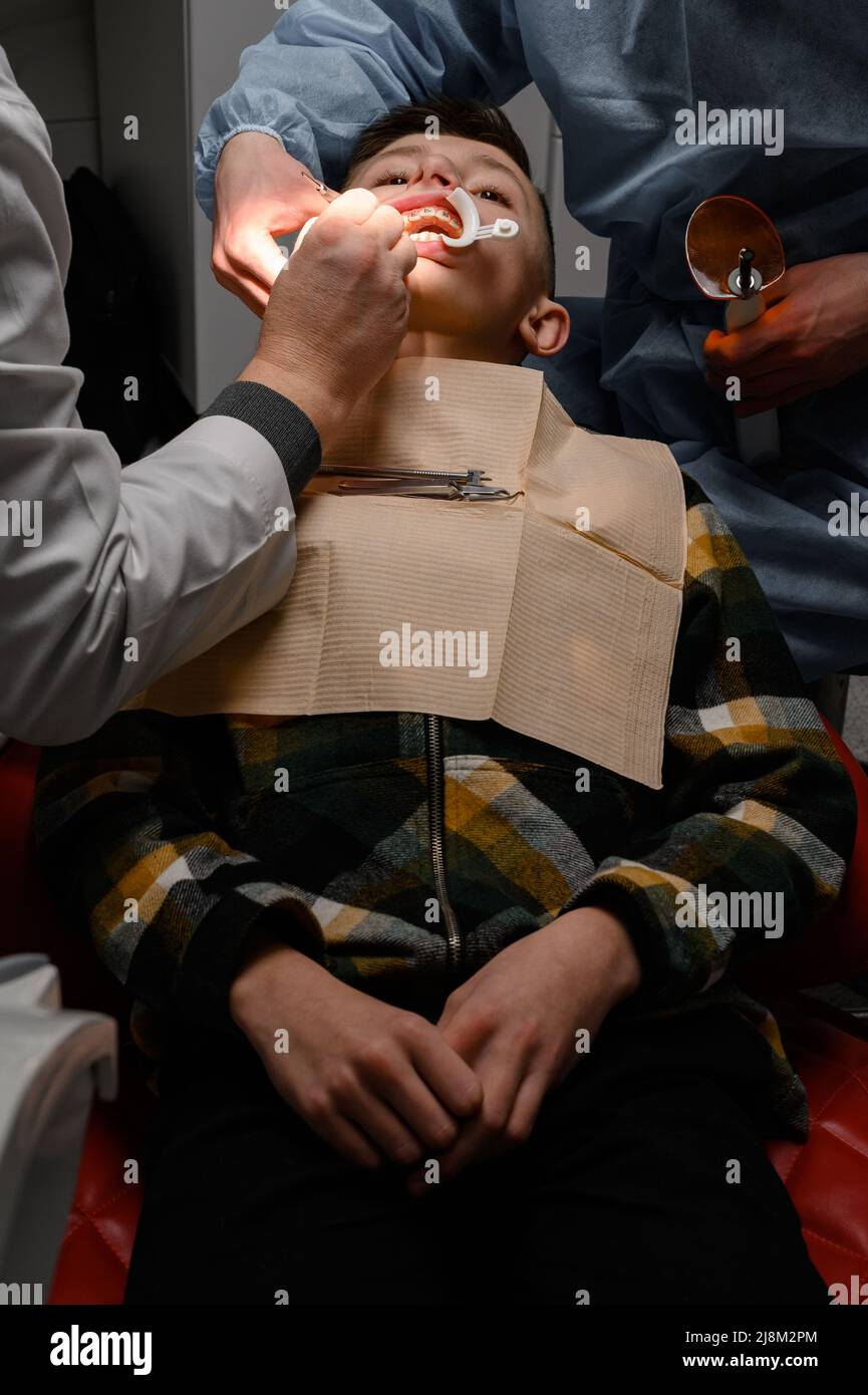 Alignment of crooked teeth with the help of braces, installation of ...