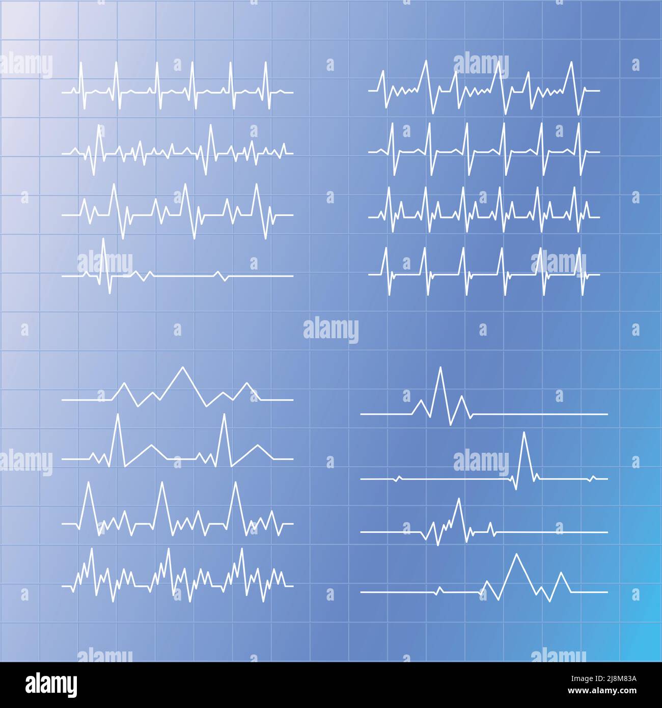Medical set of 16 pcs. pulse lines - Vector illustration Stock Vector ...