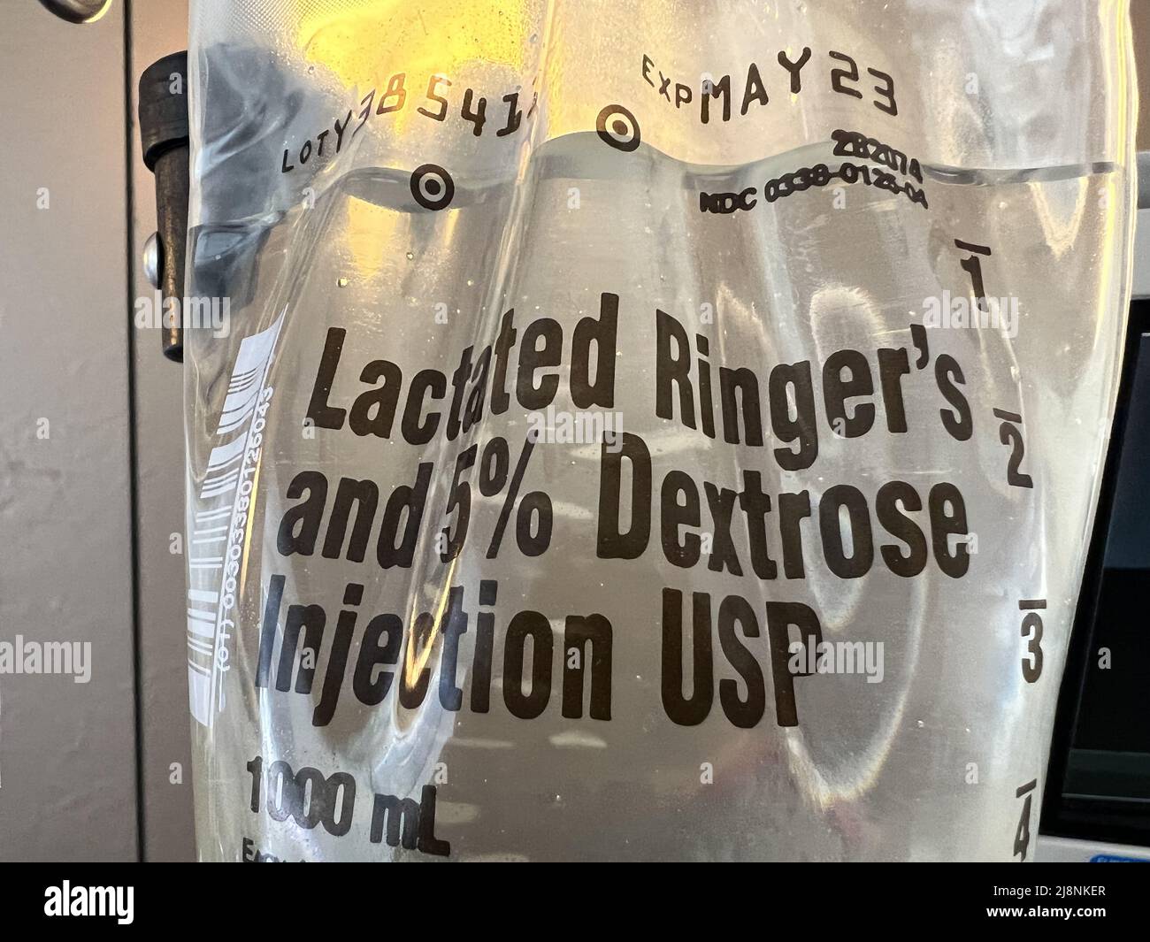 IV bag containing lactated ringers solution with dextrose in a hospital ...