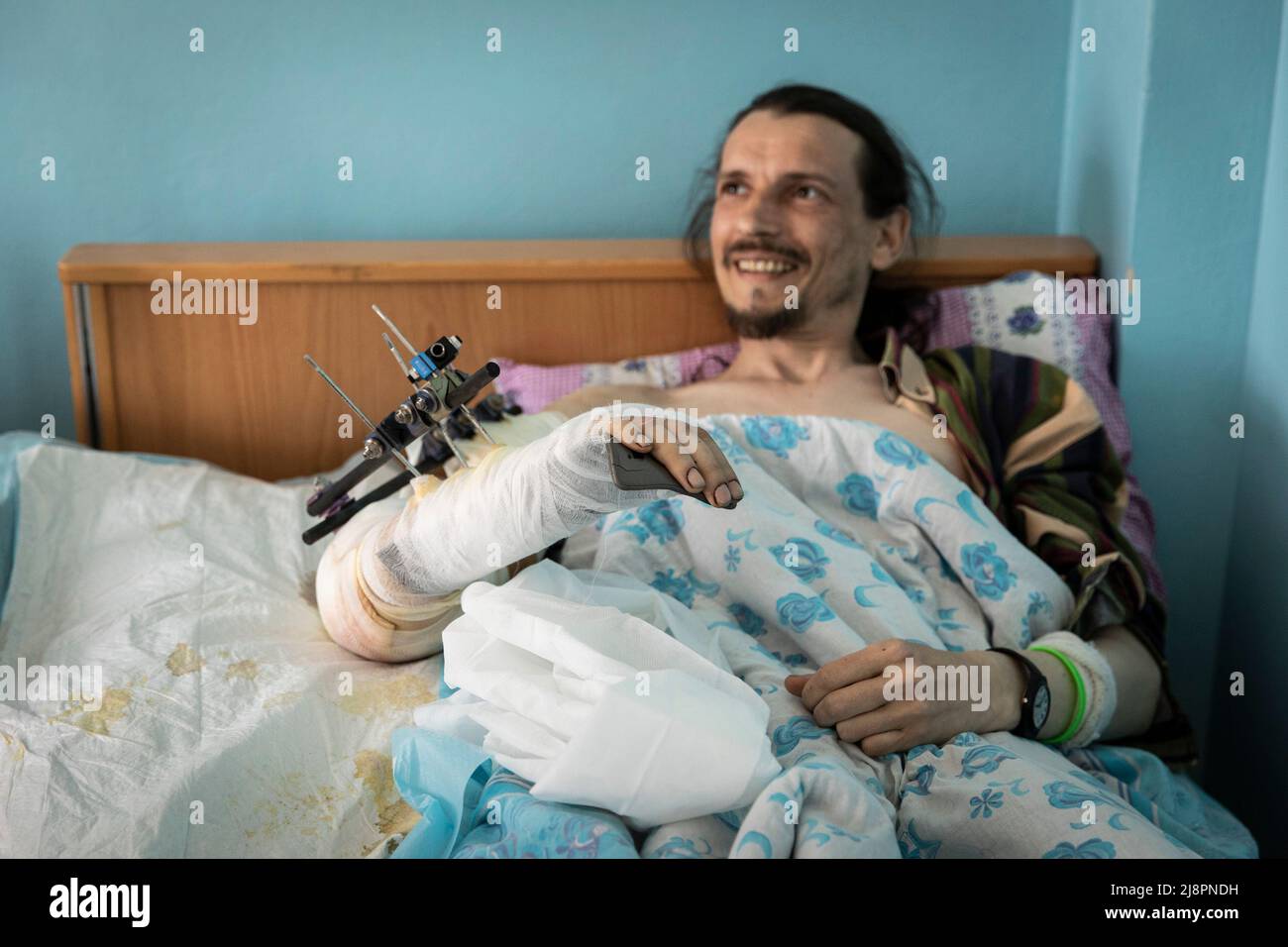 Solider Mikhail smiles as he shows an injury of a bone fracture on his ...