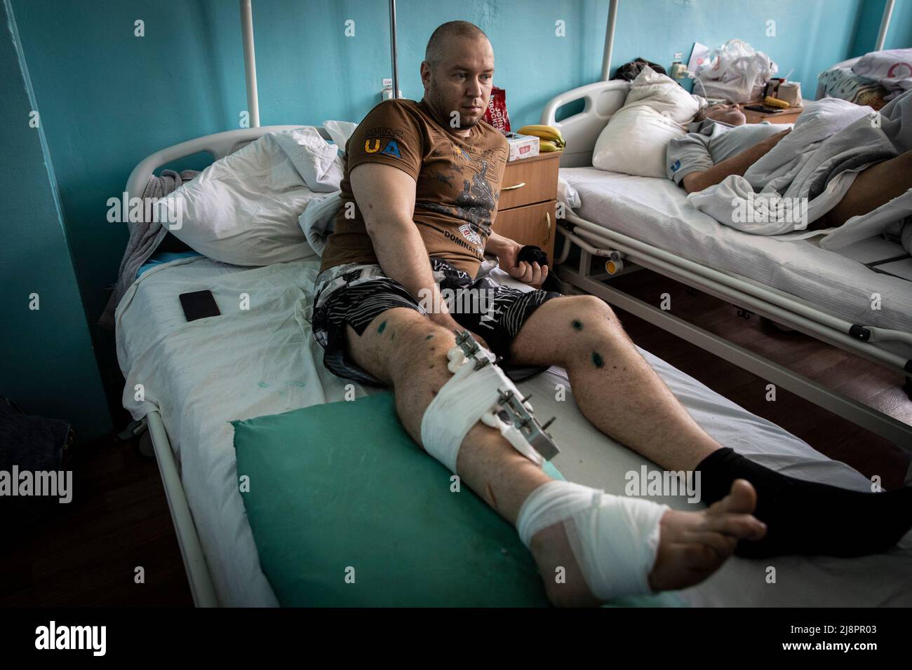 At a hospital located in Dnipro, Soldier Sergei (38) shows his injuries ...
