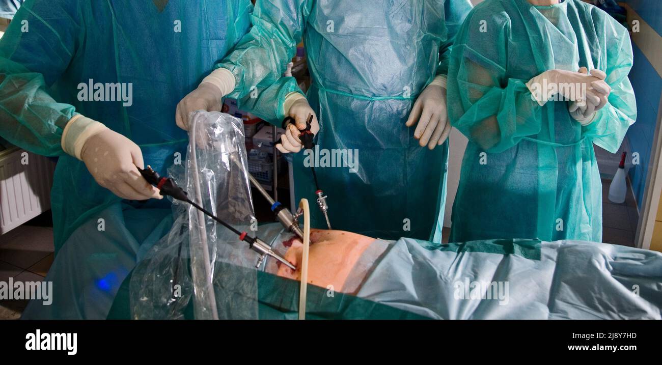 Laparoscopy hernia hi-res stock photography and images - Alamy
