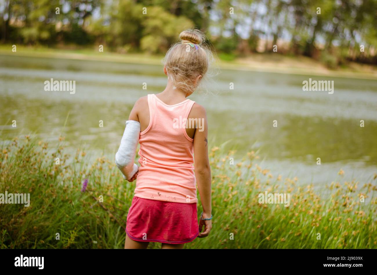 little child with bandage on broken hand standing back view in green ...
