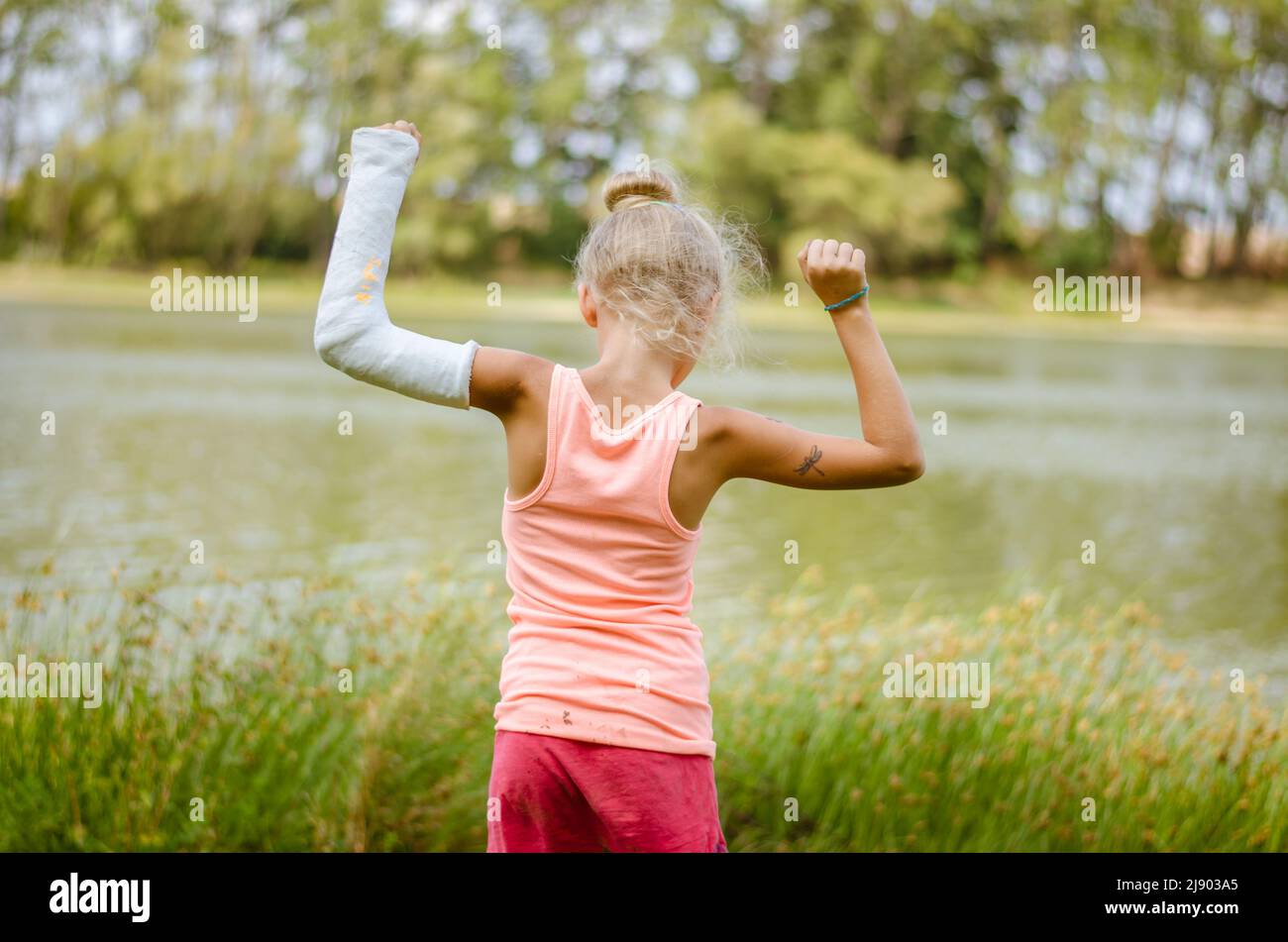 little child with bandage on broken hand standing back view in green ...