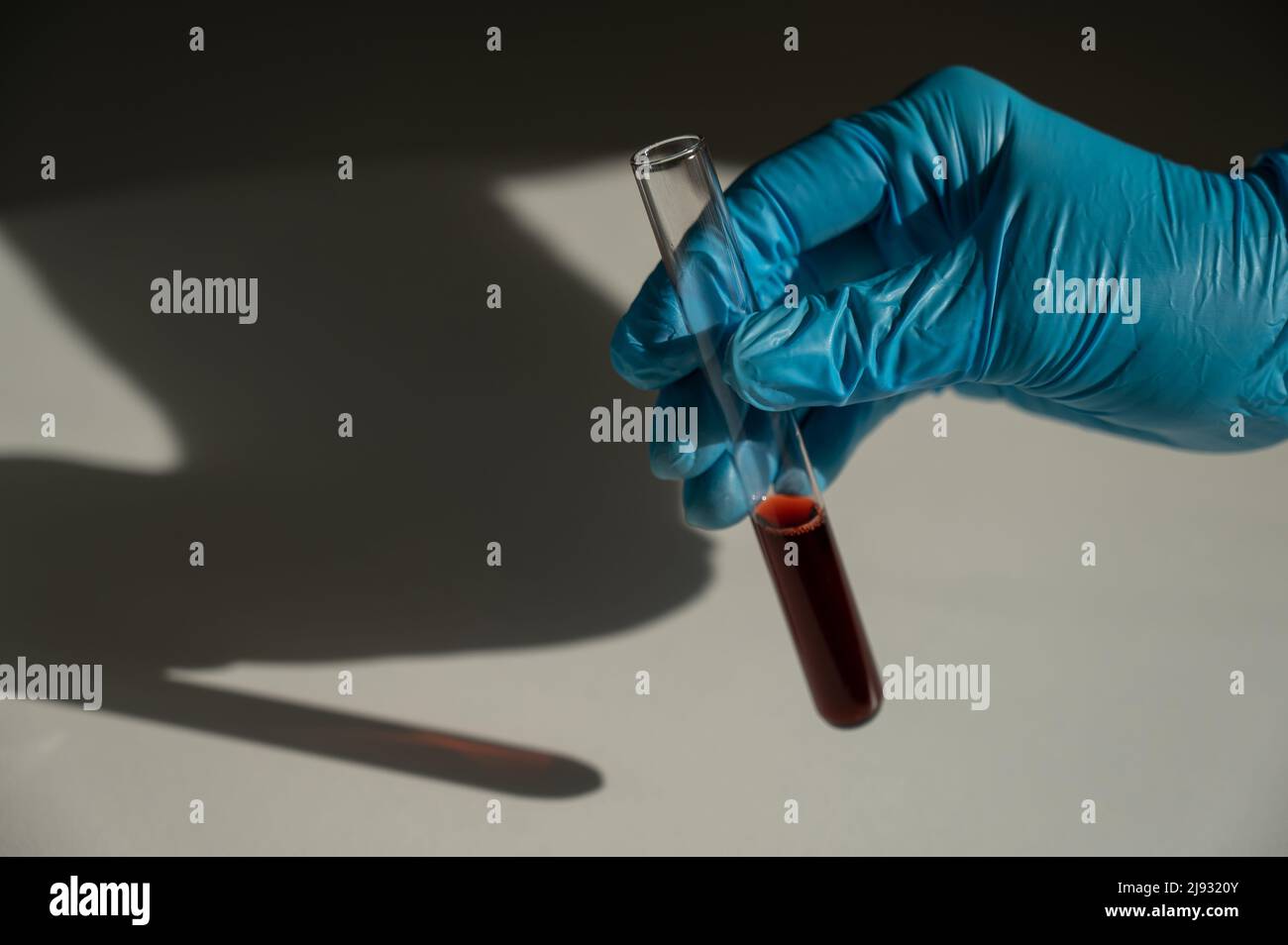 Hand holds blood tube hi-res stock photography and images - Alamy