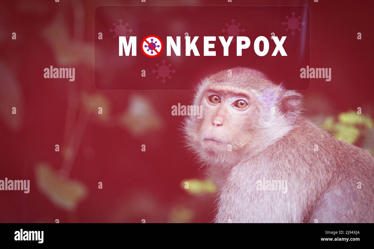 Monkeypox outbreak concept. Monkeypox is caused by monkeypox virus ...