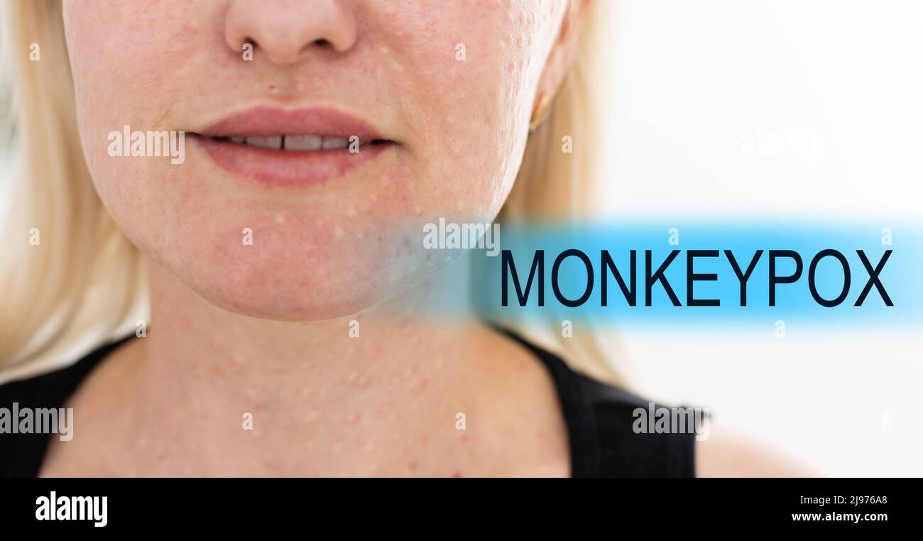 Real skin Biorevitalization on white background. Traces of ...