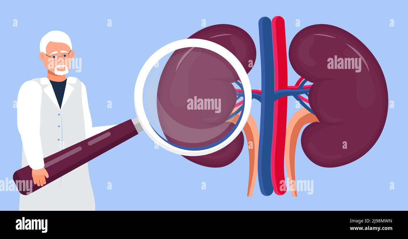 Nephrologist and nephropathy concept vector. Tiny doctors treat, looks through a magnifying ...