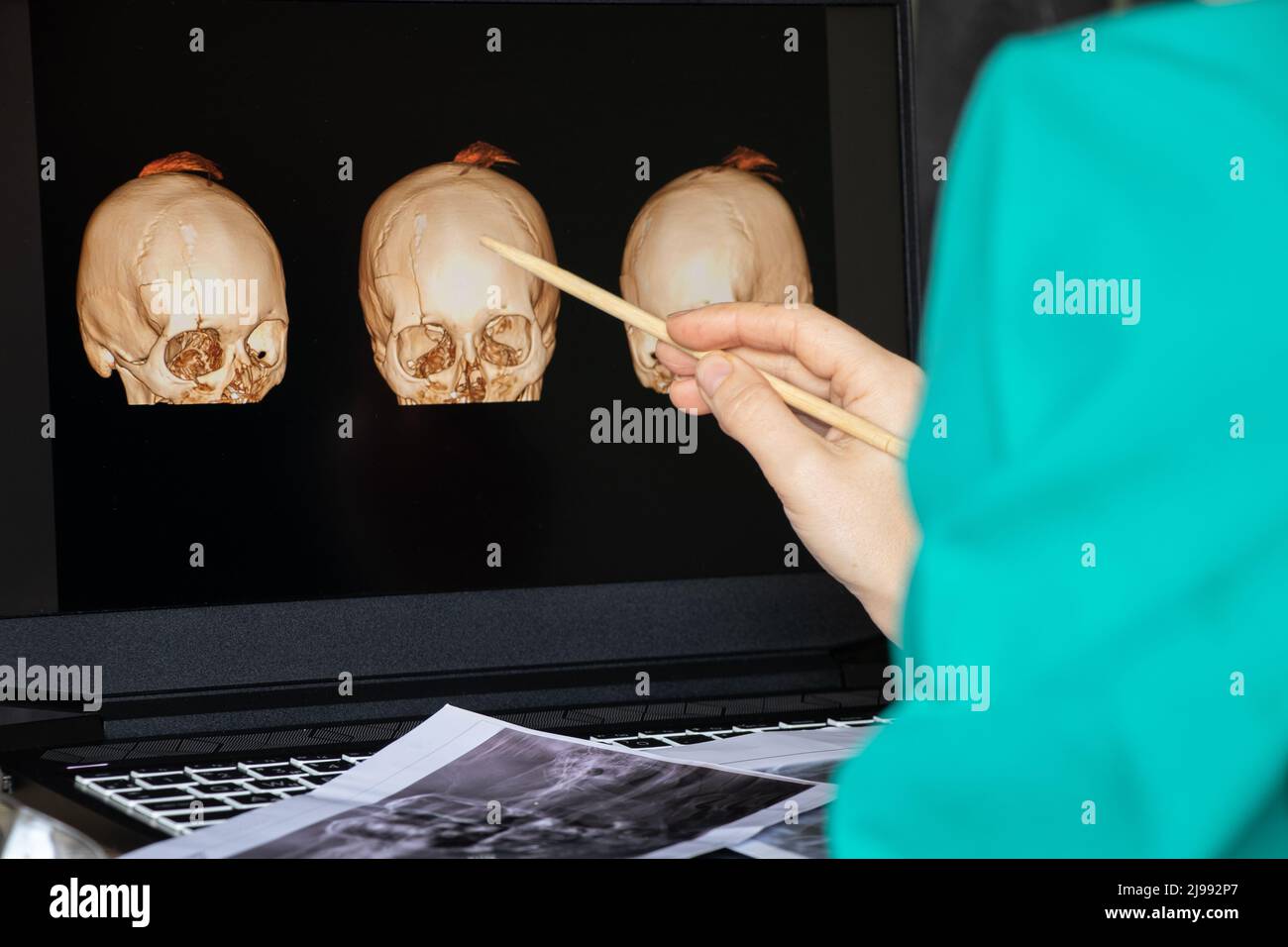 3d ct scan head hi-res stock photography and images - Alamy