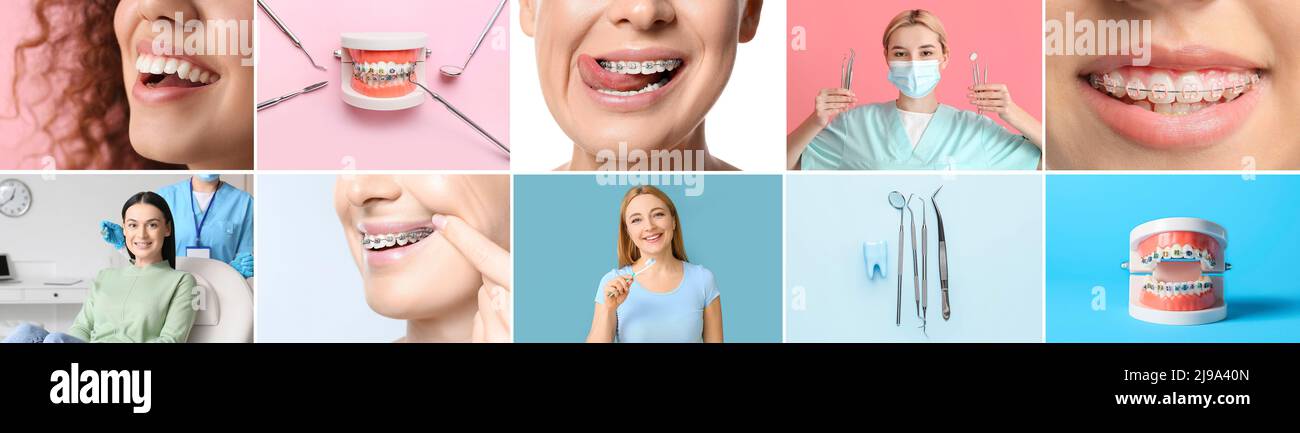 Set of women with dental braces, tooth bush and dentist with tools ...