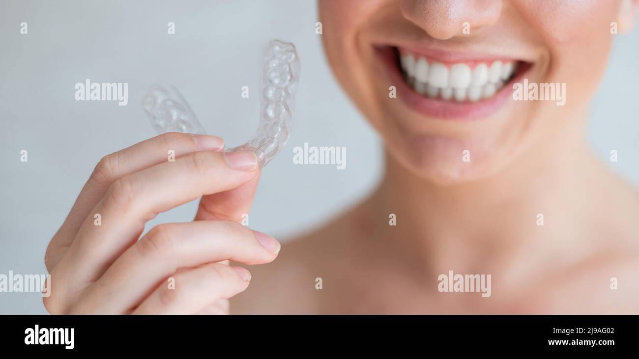Close-up of orthodontic silicone transparent teeth aligner in female ...