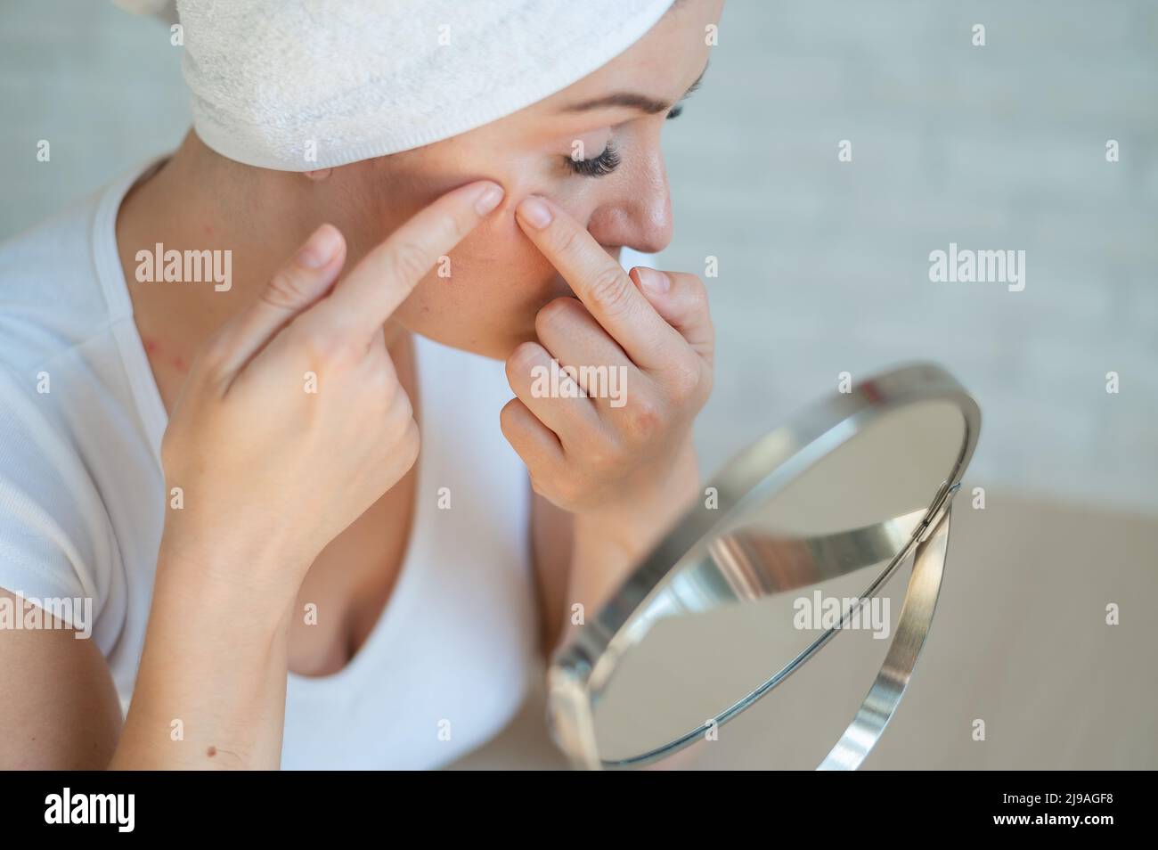 Caucasian woman with a white terry towel on her head crushes pimple ...