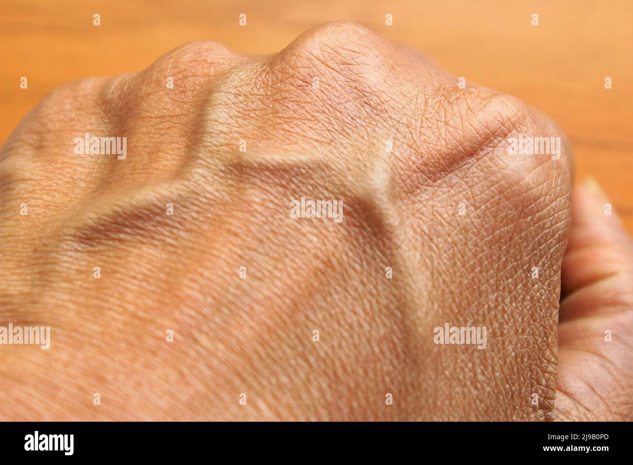 Bulging veins on the back of the hand. close up photo Stock Photo - Alamy