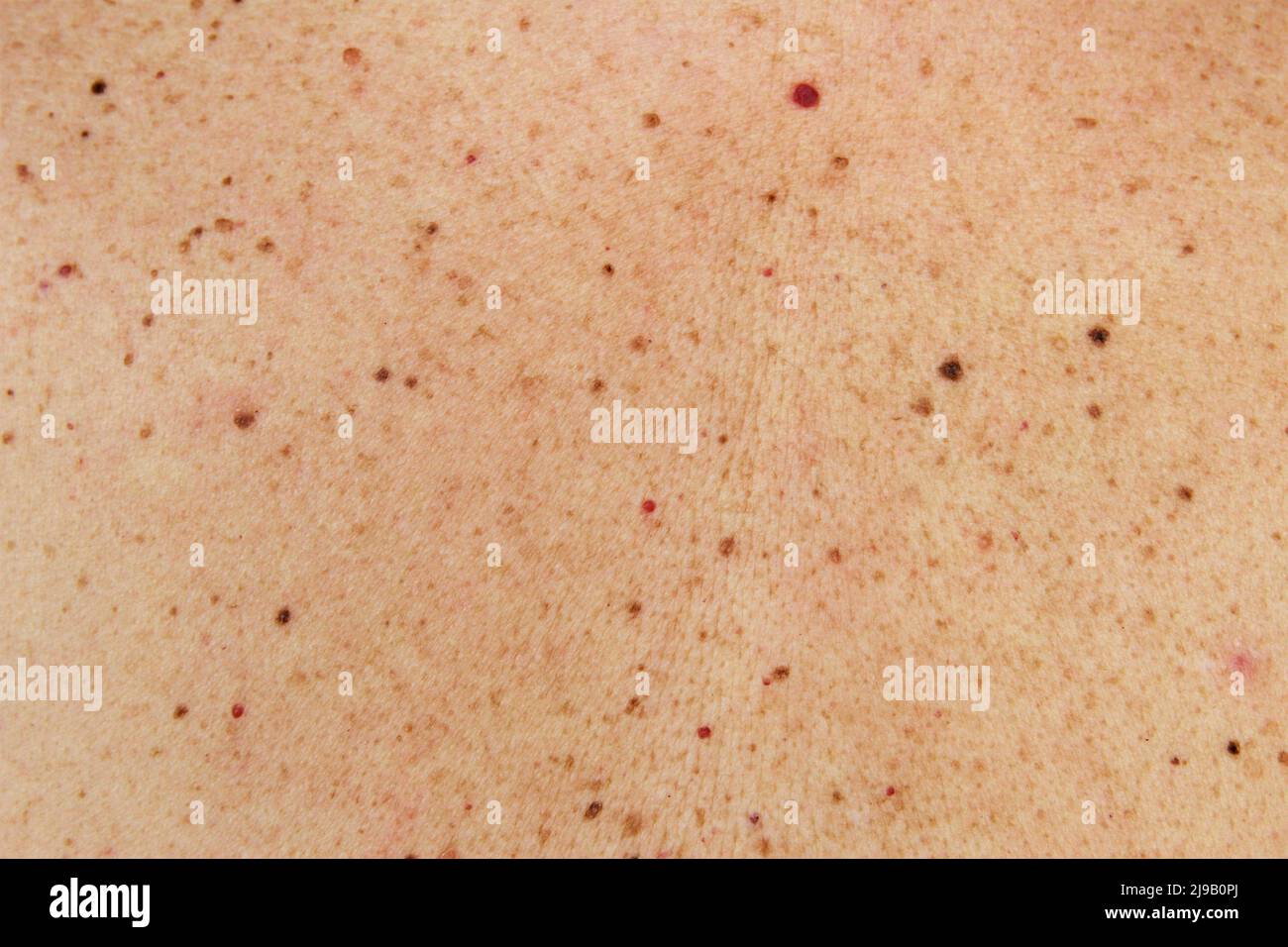 Human skin texture hi-res stock photography and images - Alamy