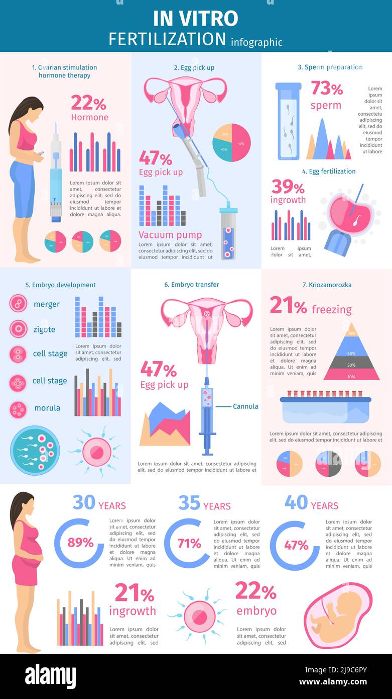 Insemination procedure flat infographic concept with elements and steps ...