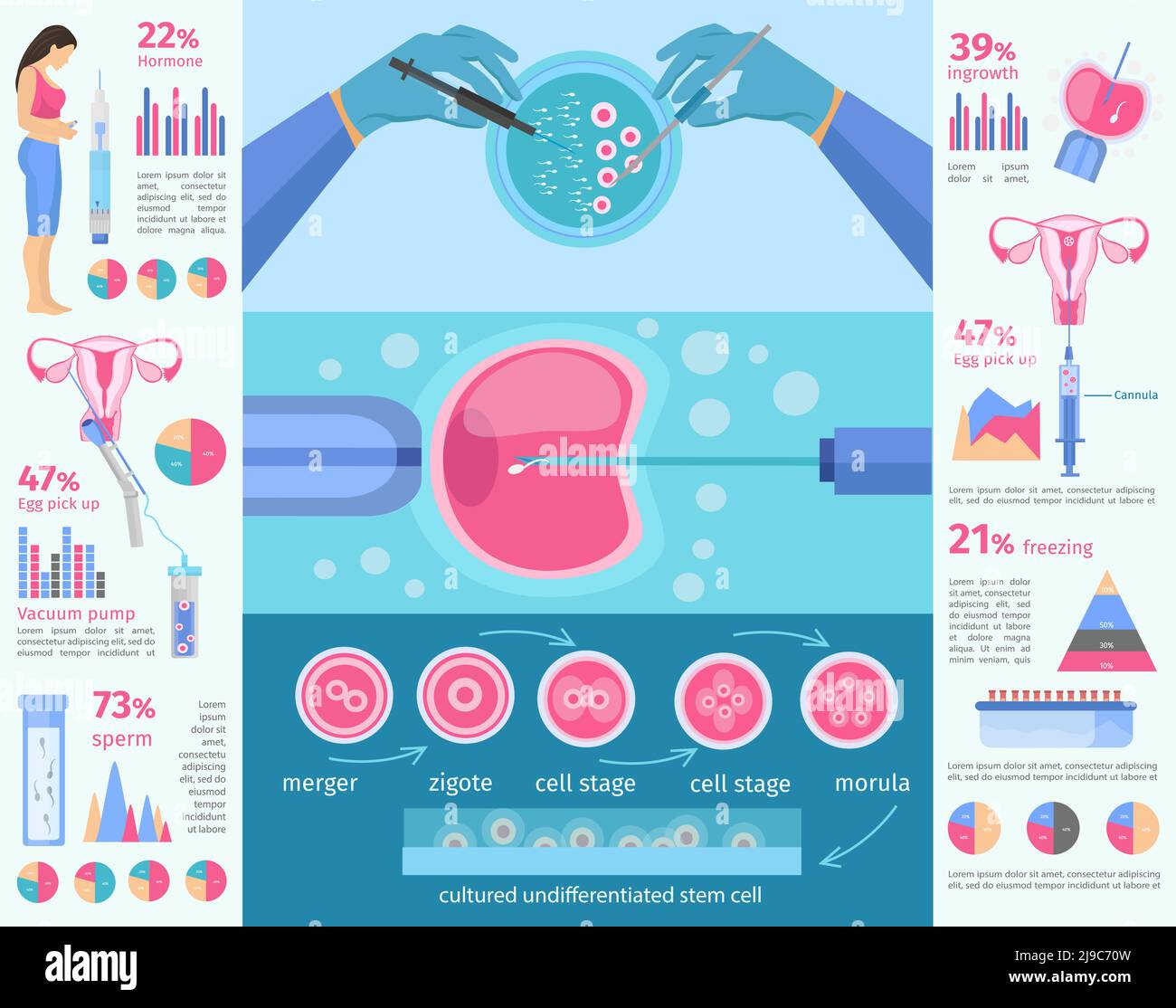 in vitro fertilization flat infographic template with diagrams charts ...
