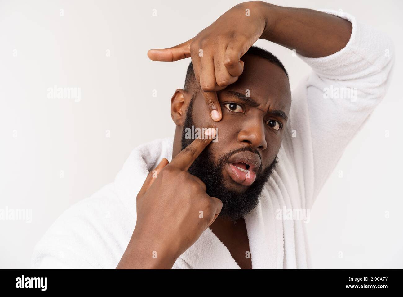 African American man looks at pimples on face. Acne. Male hygiene ...