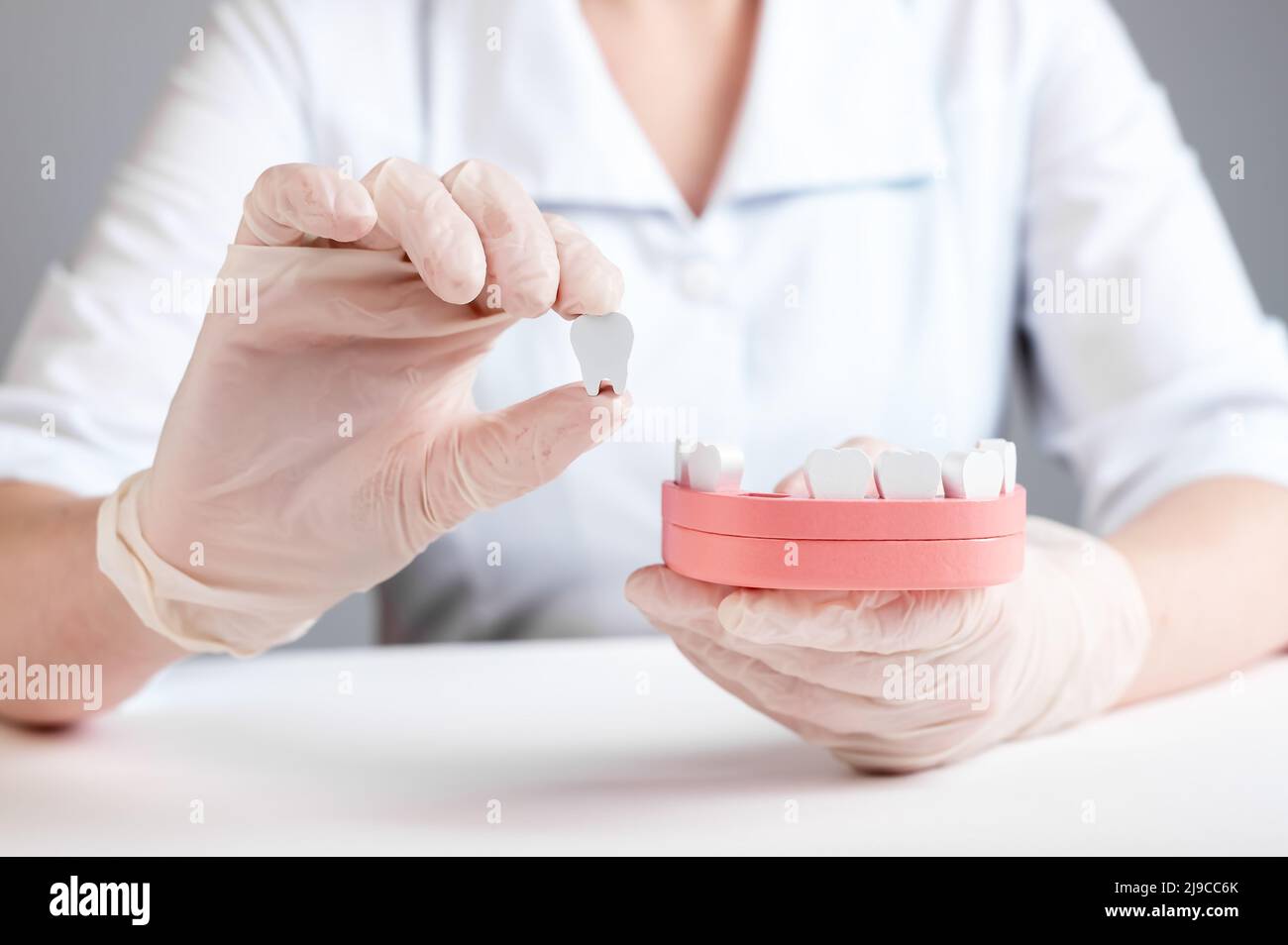 Dental implantation. Dentist holding tooth and jaw models. Restoration ...