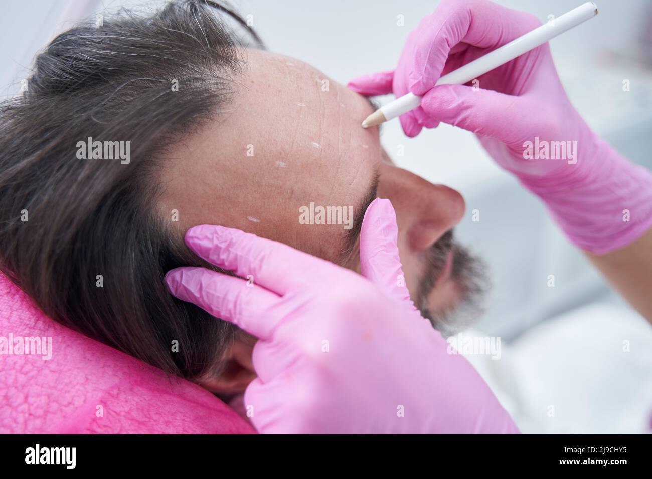 Cosmetologist making marks on male client forehead before rejuvenation ...