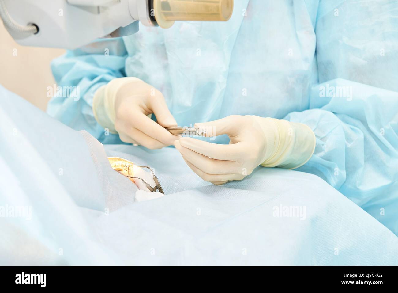 Ophthalmology laser microscope operation. Doctor surgery in clinic ...