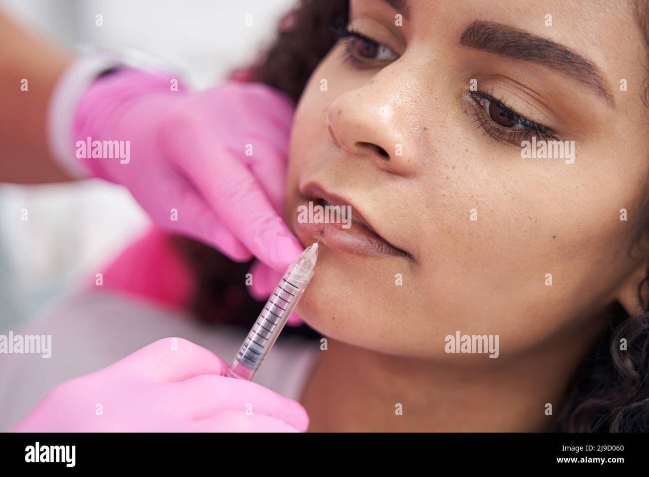 Lip augmentation procedure performed on the face of young patient Stock ...