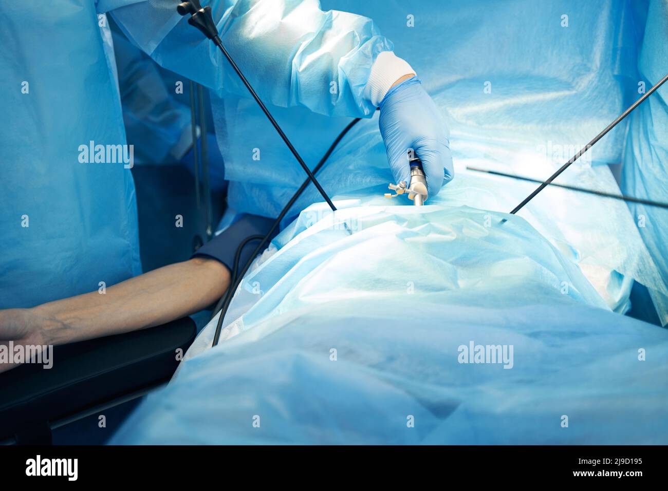 Hand of doctor putting surgical camera inside patient abdomen Stock ...