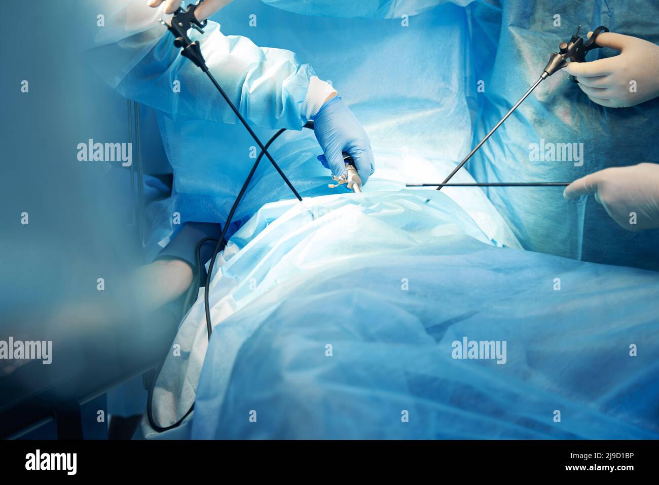 Doctors using laparoscopic camera while performins surgery Stock Photo ...