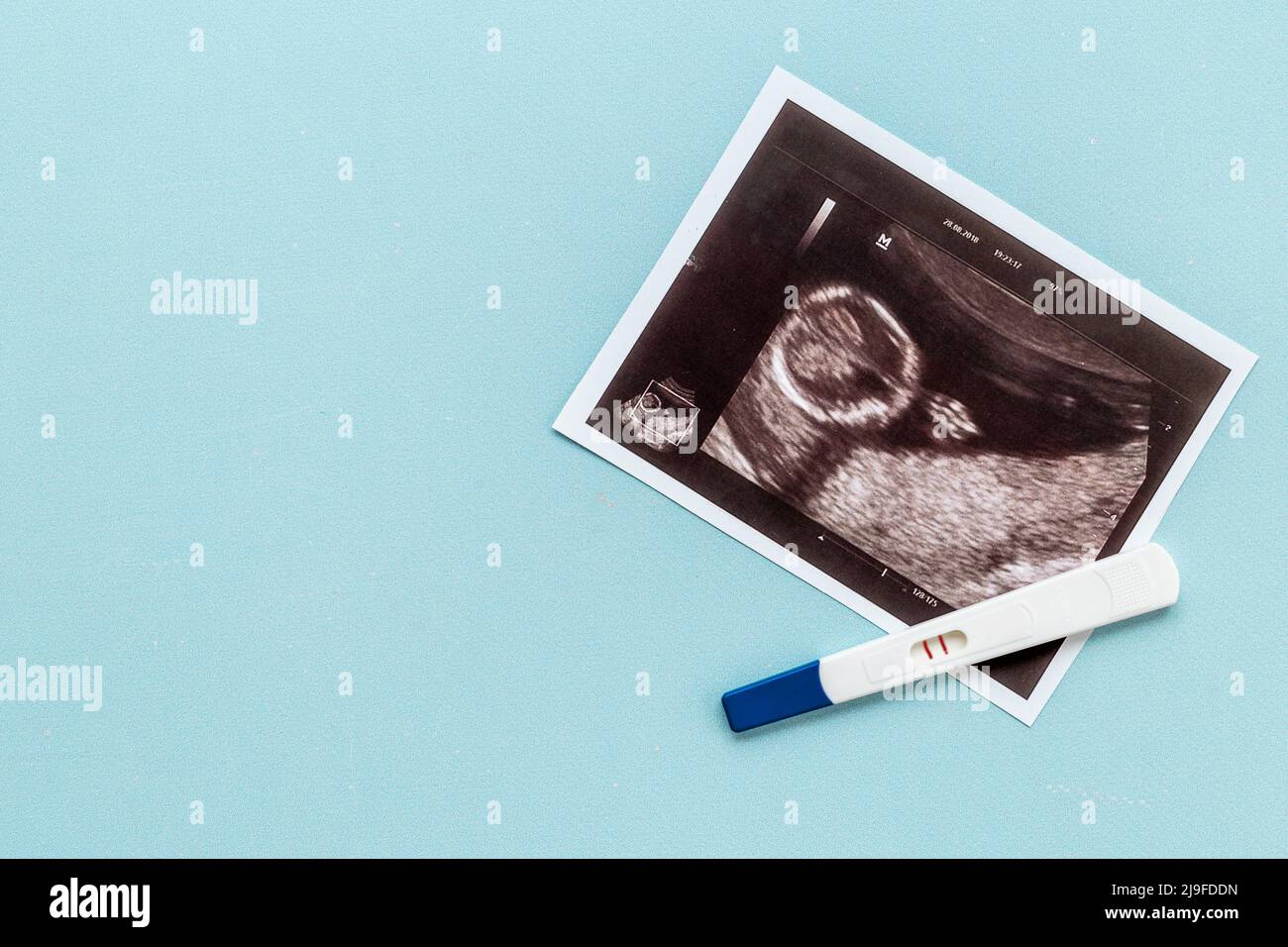 Positive pregnancy test with ultrasound picture of unborn baby Stock ...