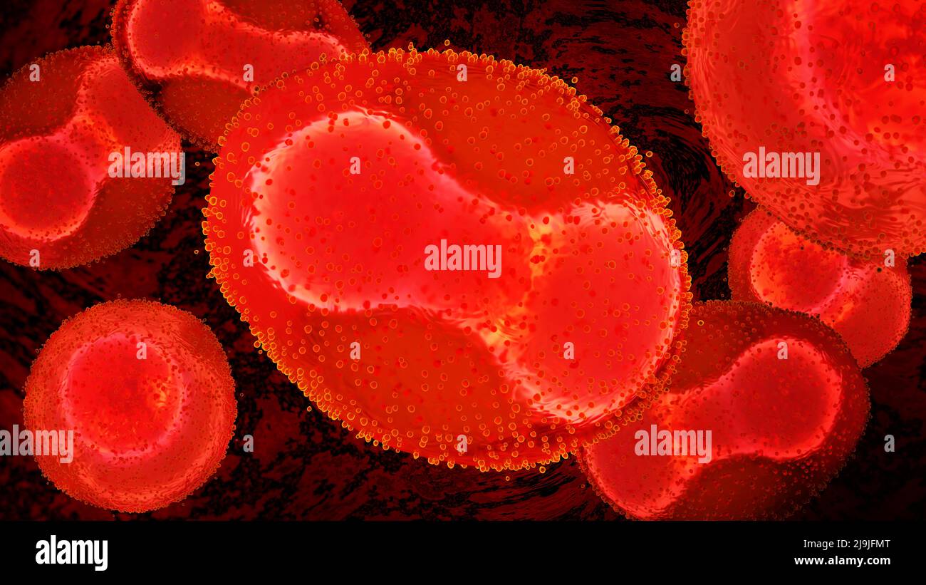 Monkeypox virus, closeup, infectious zoonotic disease that causes ...