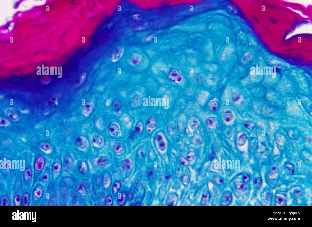 Under a magnification of 500X, this image depicted a section of skin ...