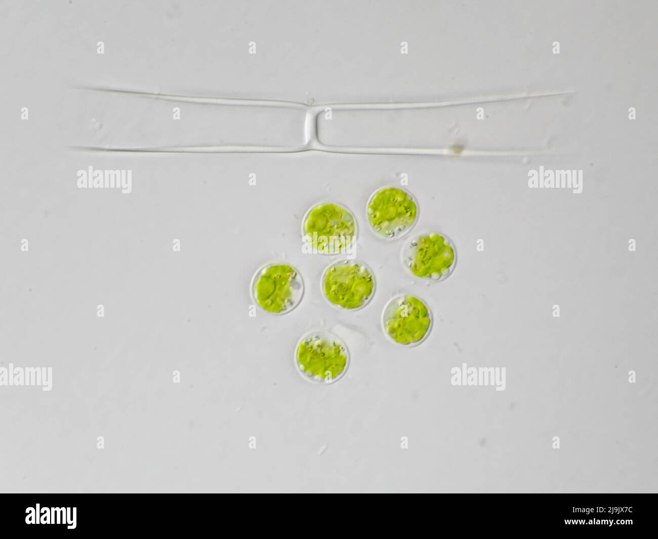 Fresh water algae under the microscope, horizontal field of view about ...