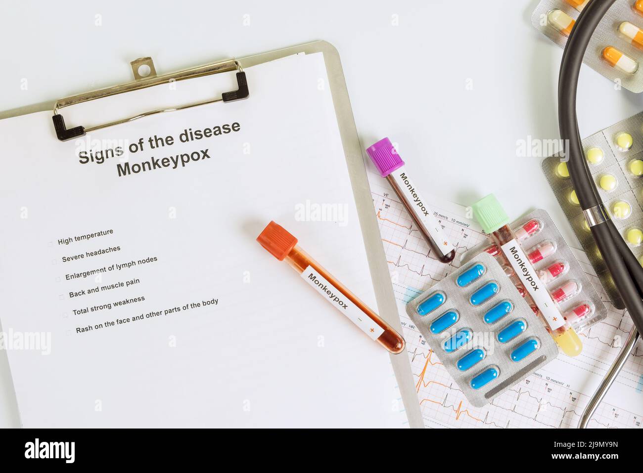 Monkeypox virus infection blood sample test with pills, tablets blood ...