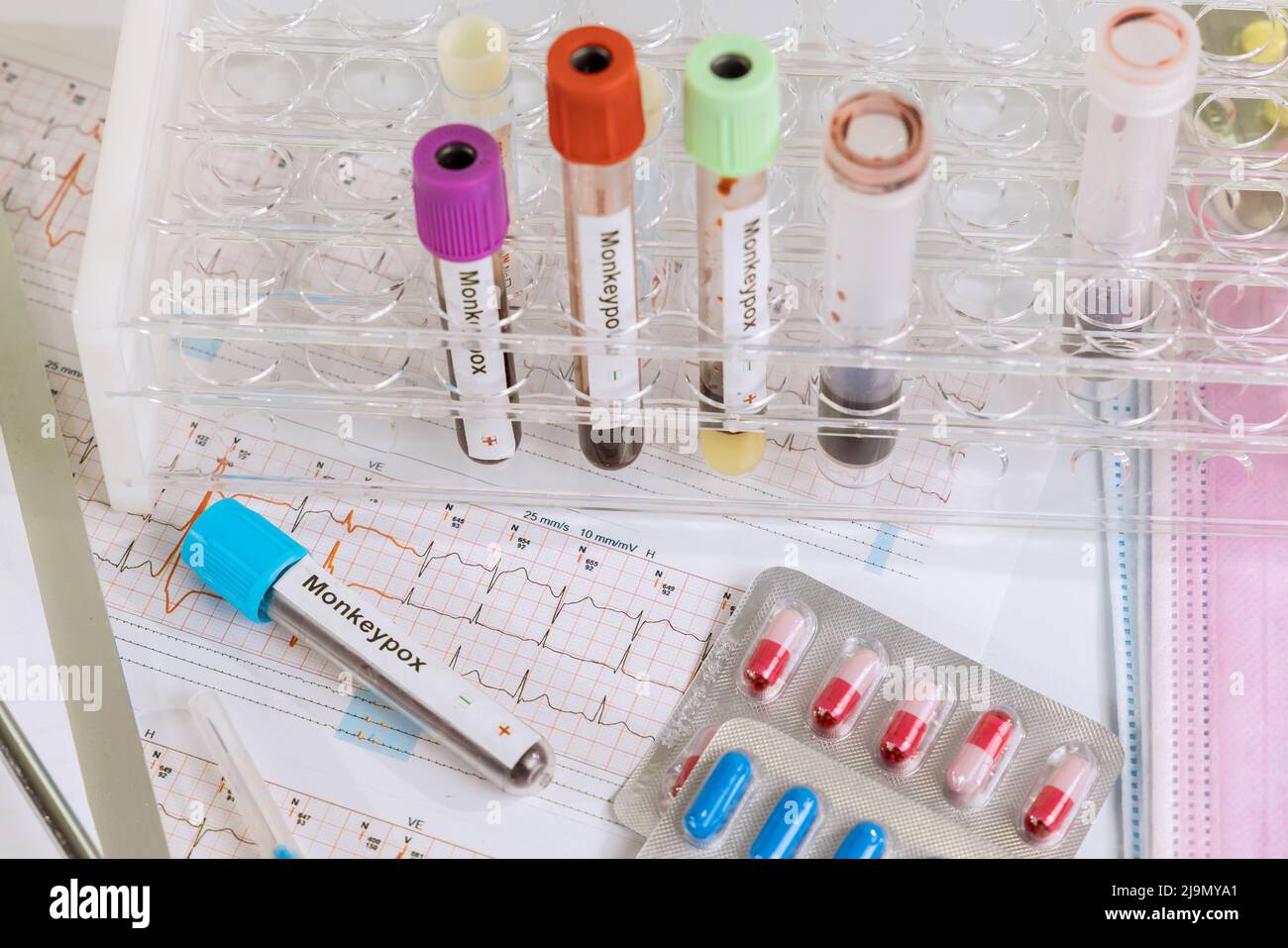 Blood sample many others blood test tubes exam analysis hospital ...