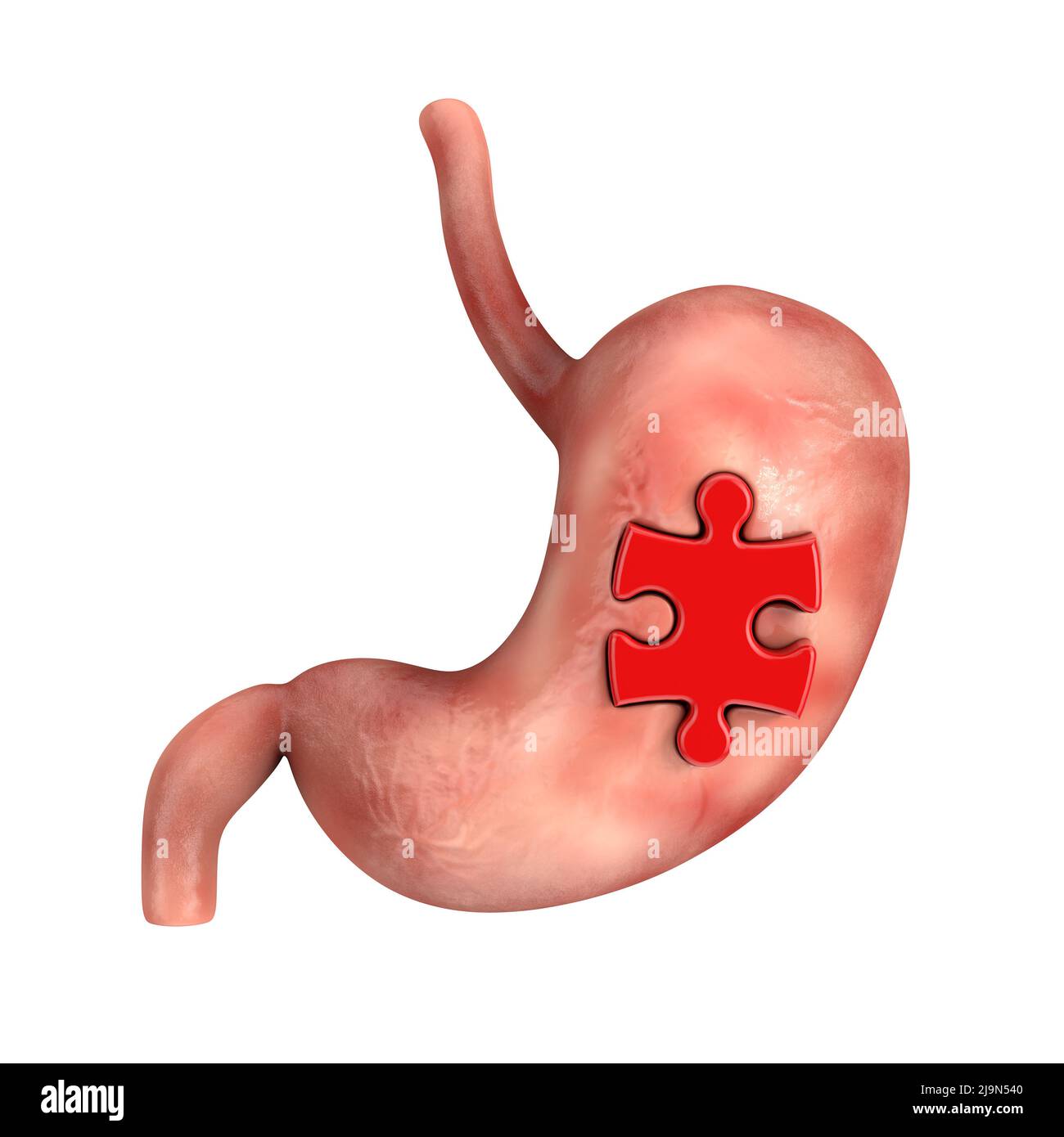 Stomach Surgery Concept. Human Stomach Anatomy Internal Organ with Red ...