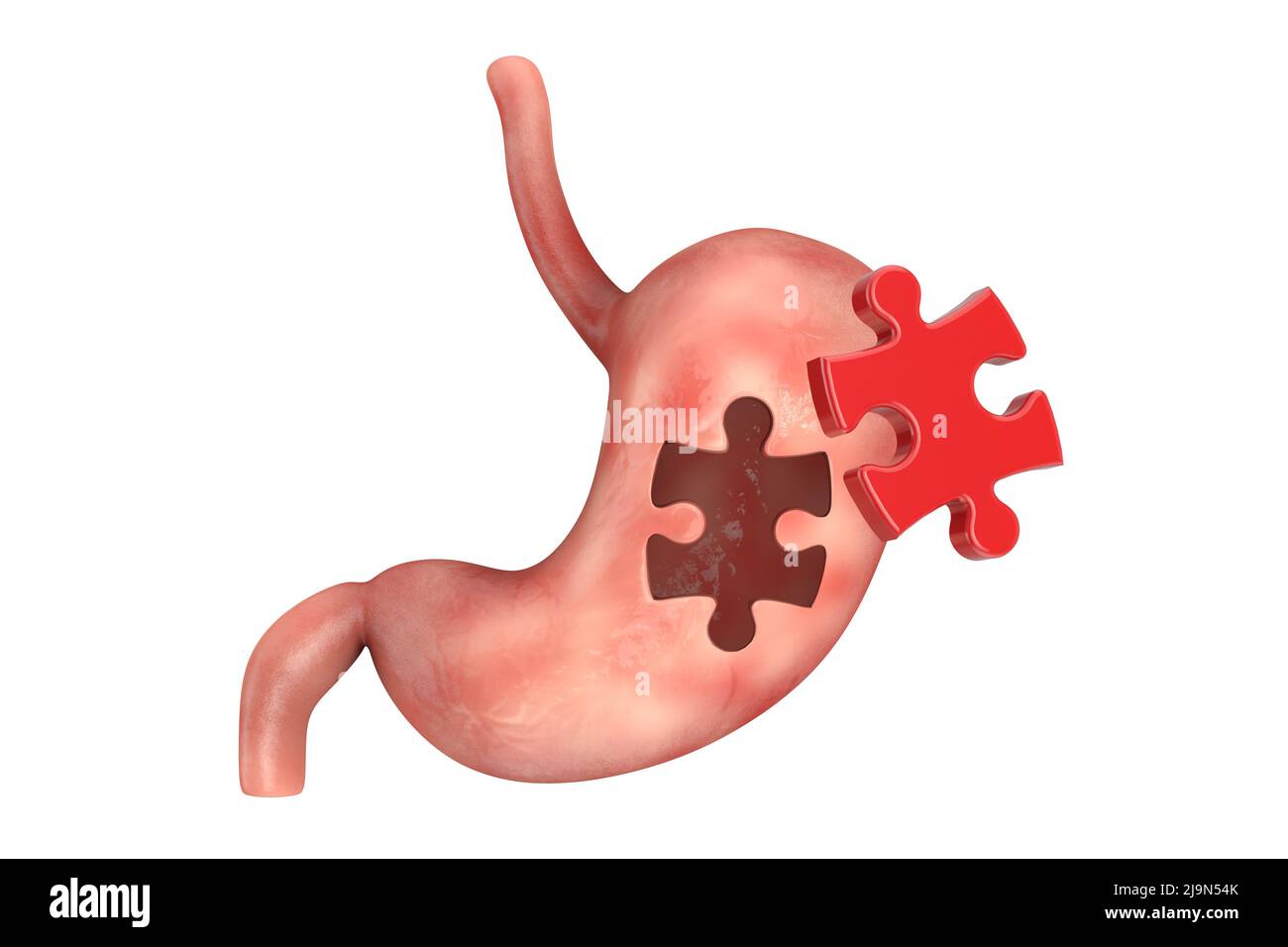 Stomach Surgery Concept. Human Stomach Anatomy Internal Organ with Red ...