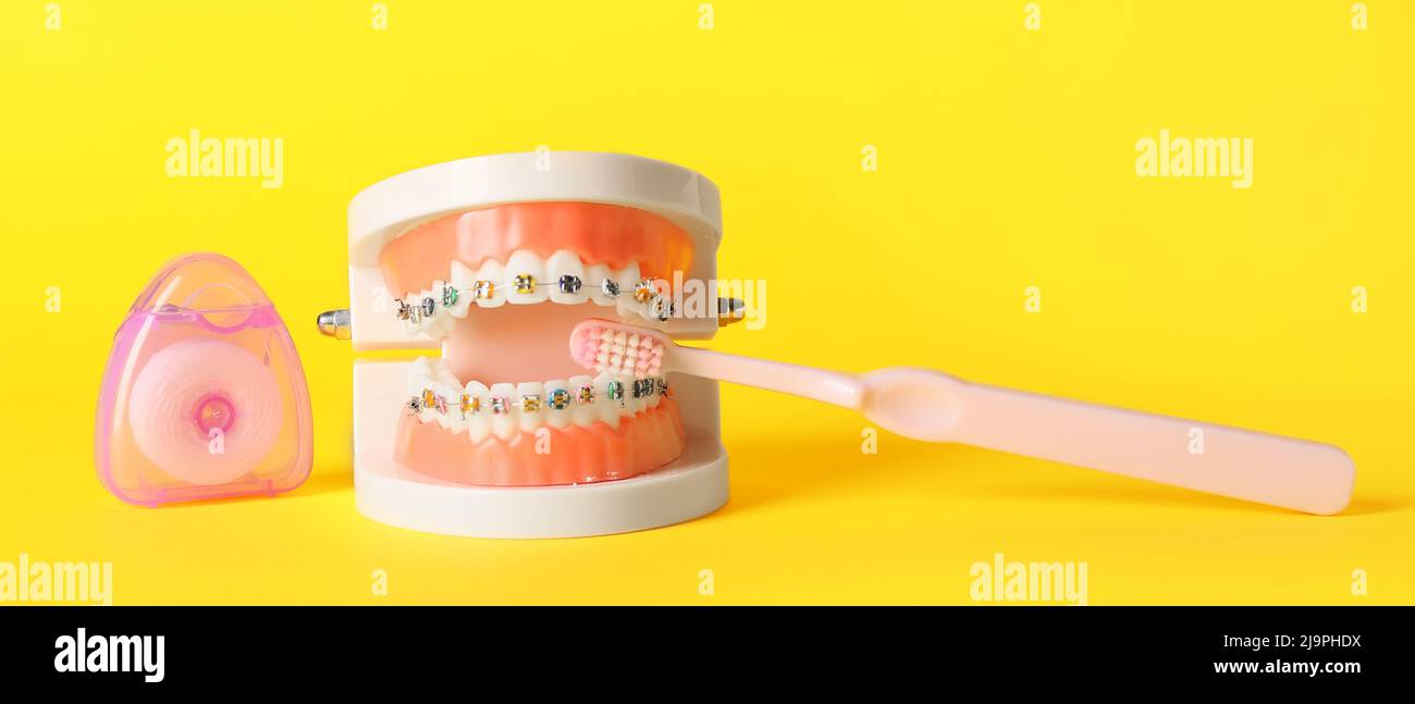 Model of jaw with braces, dental floss and tooth brush on yellow ...