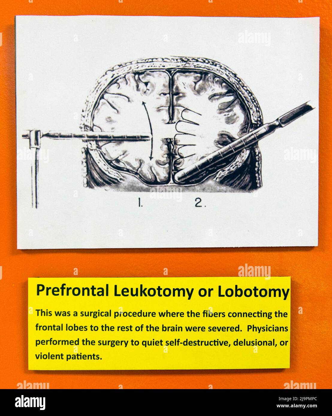 St. Joseph, Missouri, USA. 24th May, 2022. The Glore Psychiatric Museum ...