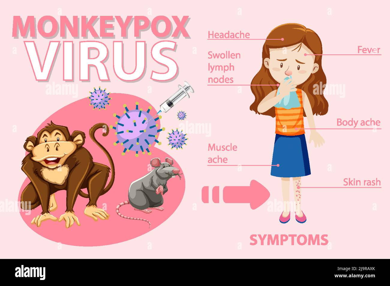 Monkey pox vector vectors hi-res stock photography and images - Alamy
